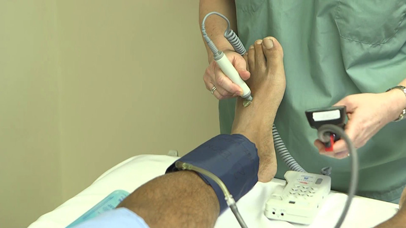 Peripheral Artery Disease Webinar Series American Heart Association
